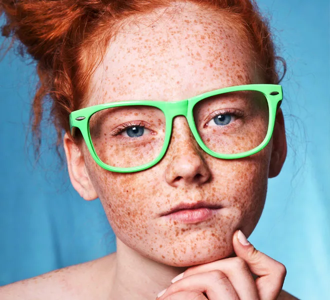 All about freckles - Beauty South Africa
